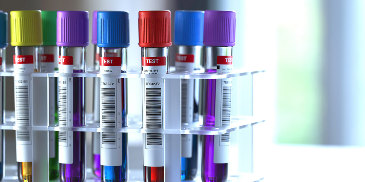 Hunt Regional Lab Solutions